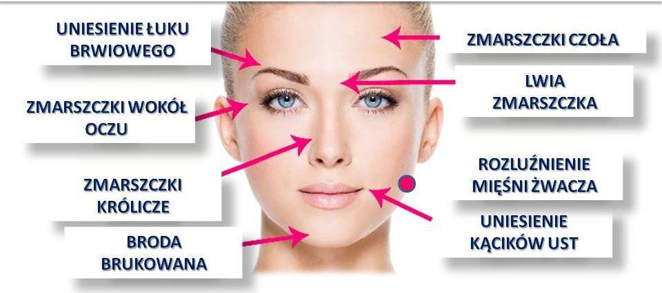 Zastosowanie kwasu hialuronowego i botoxu w zabiegach medycyny ...
